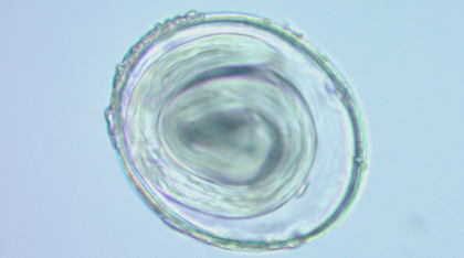 The oldest parasite DNA ever recorded has been found in the ancient ...